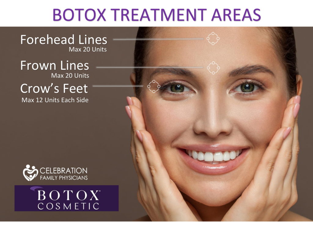 Botox Treatment Flyer-1 | Celebration Family Physicians